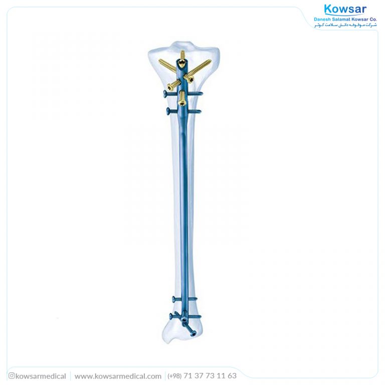 Expert Tibial Nail - شرکت موقوفه دانش سلامت کوثر